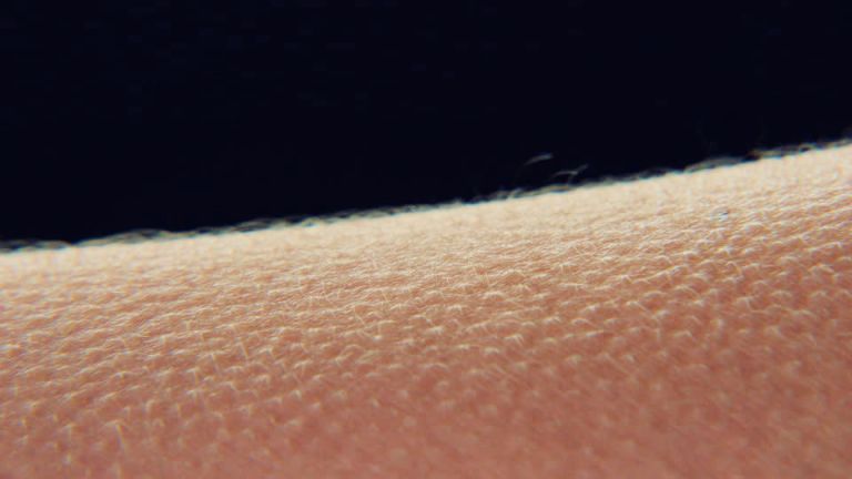 Word Nerd: Horripilation – Lawhimsy